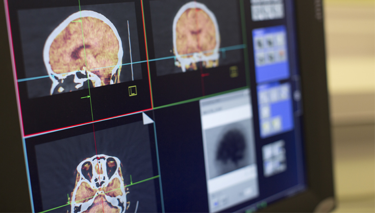 Spotlight On Clinical Imaging Facility At Imperial College London